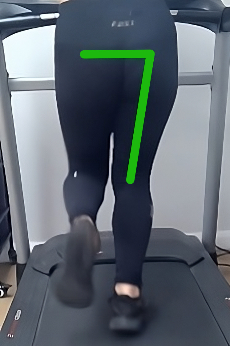 Running Analysis – Totnes Physio Clinic
